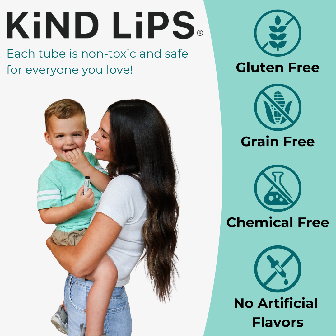 Kind Lips Cherry Lip Balm - Moisturizing Cherry Flavor — Little Red ...